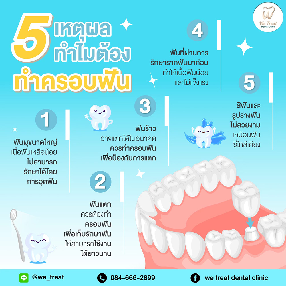 5 เหตุผลทำไมต้องทำครอบฟัน - We Treat Dental Clinic คลินิกทันตกรรมวีทรีท
